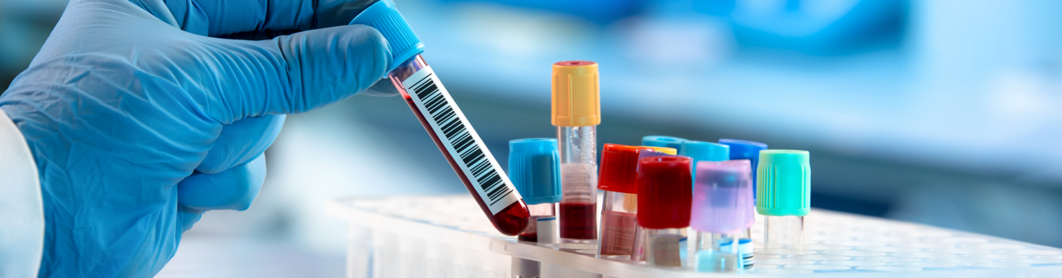 bloedafname – Gezondheidscentrum Didam